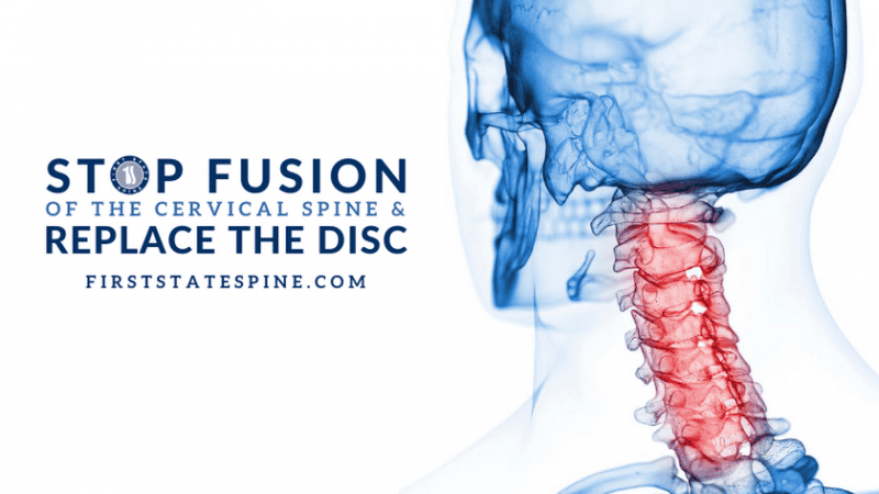 Cervical Surgery Archives - First State Spine