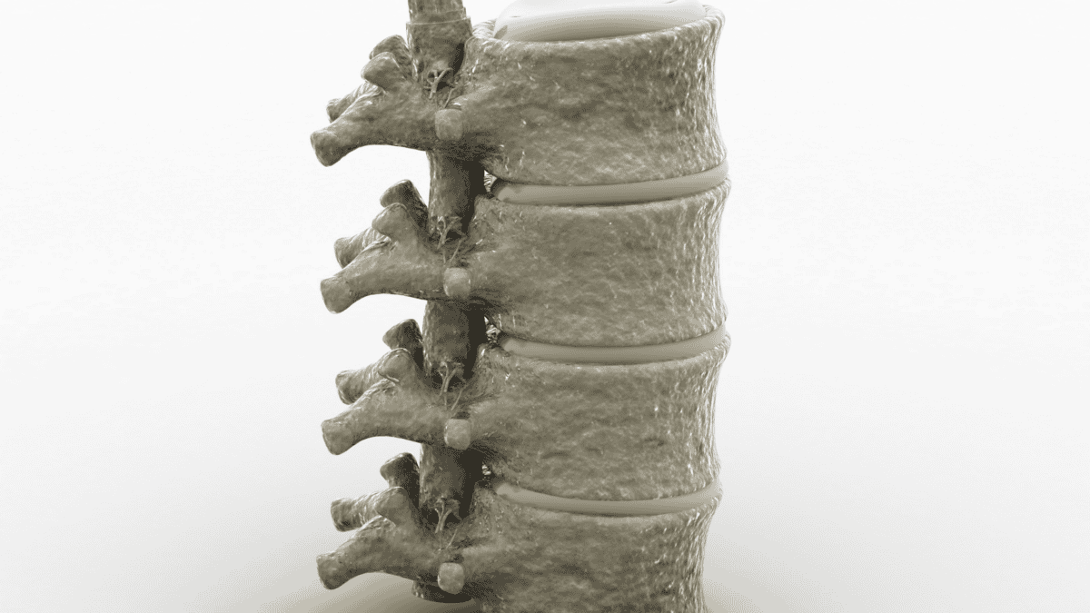 Spine Surgery Archives - First State Spine